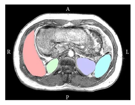 manual segmentation of abdominal organs a and 3d model of abdominal download scientific