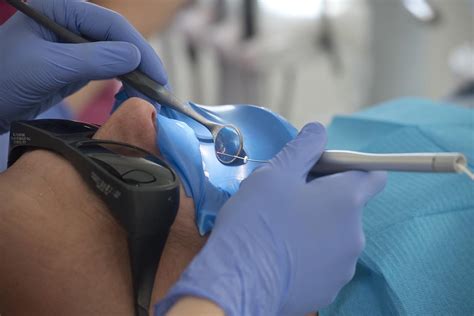 Leczenie kanałowe pod mikroskopem Usługi PrecisDENT Stomatologia