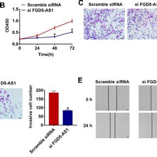 Silencing LncRNA FGD5 AS1 Inhibits Proliferation Migration And