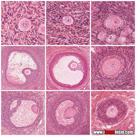 Ovary Histology Slide Labeled