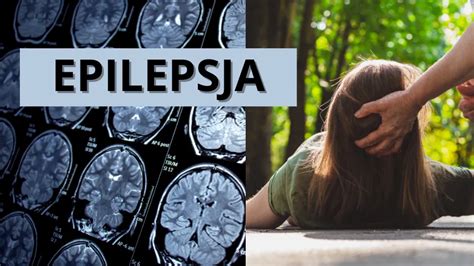 Epilepsja co warto o niej wiedzieć iJarocin pl lokalna Gazeta