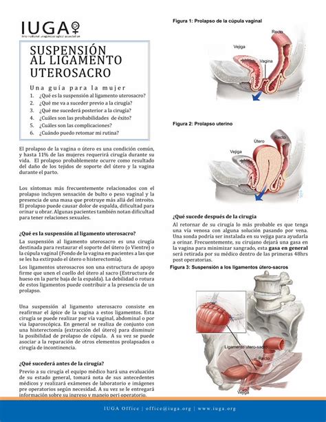 PDF Recto SUSPENSIÓN AL LIGAMENTO UTEROSACRO prolapso incluyen
