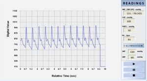 Central Aortic Systolic Pressure Casp Peter Yan Cardiology Clinic