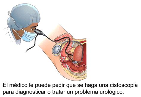 PatEdu La Cistoscopia Varones