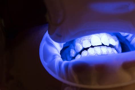 Planificación del tratamiento periodontal