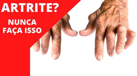 Artrite Sintomas Tratamentos Causas