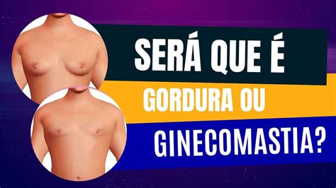 COMO SABER SE VOCÊ TEM GINECOMASTIA Dr Cristian e Dra Raquel YouTube