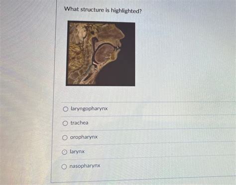 Solved Which Structure Is Highlighted O Pyloris O Cardia Chegg