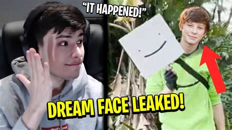 Aches Face Reveal Leak