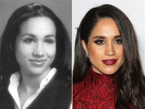 Meghan Markle Before And After In Celebrity Plastic Surgery