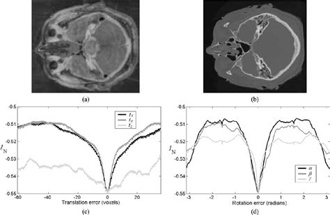 figure 2 from an approach to multimodal biomedical image registration utilizing particle swarm
