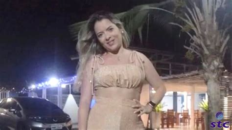 Mulher Que Teve Corpo Queimado Por Ex Companheiro Em Fortaleza Precisa