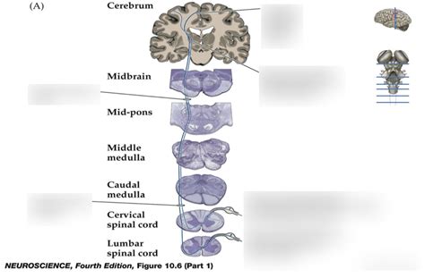 Pain And Temperature Sensation Of Trunk Limbs Neck And Back Of Head