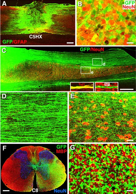 Survival Differentiation And Growth Of Human IPSC Derived Neural Stem