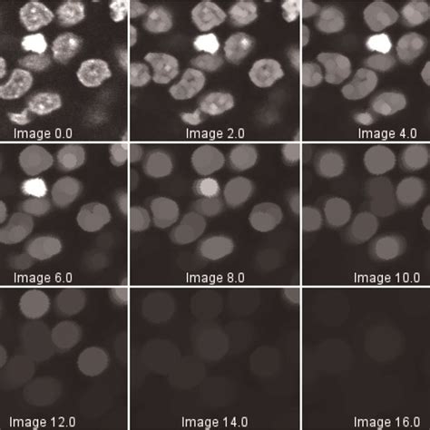 Granulometry Of Cell Nuclei An Image Of Cell Nuclei Stained With DAPI