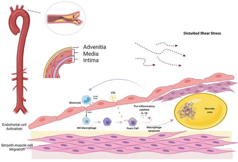 Atherosclerosis Begins With Endothelial Cell Activation The Normal