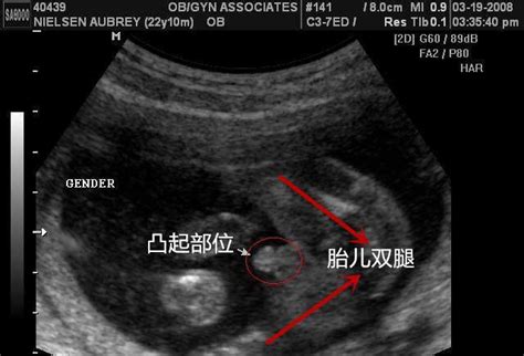 b超看男女准吗 b超看男孩有亮点 随意云