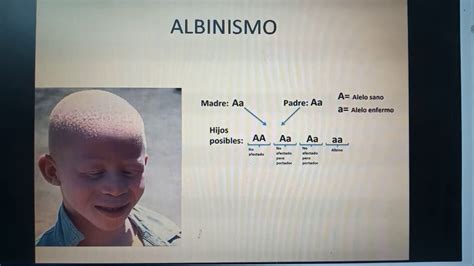 Biología 2 Mártires Anomalías humanas ligadas a los cromosomas