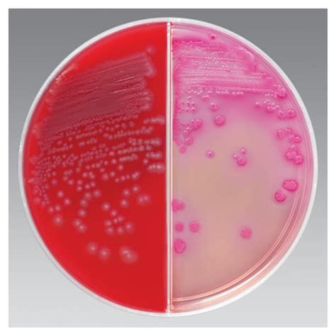 Thermo Scientific Blood Agar TSA With 5 Sheep Blood MacConkey Agar