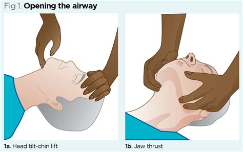 Essential Critical Care Skills 2 Assessing The Patient Nursing Times