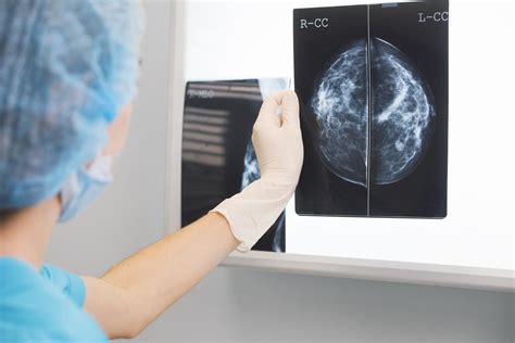 Cancer du sein triple négatif les mécanismes de résistance aux