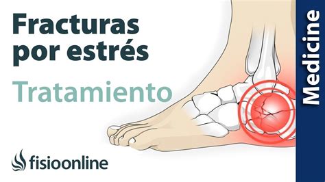 Signos De Fisura Osea Discount Varsana