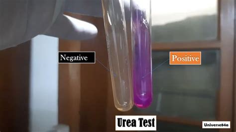 Urea Test Principle Procedure Interpretation Urease Positive Organisms