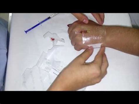 Fijacion De Cateter Con Tegaderm Y Colocion De Normogotero YouTube