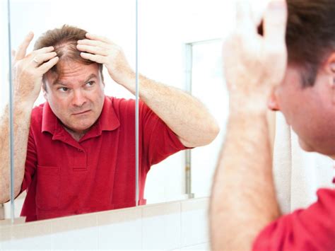 How To Tell If Youre Losing Too Much Hair And What To Do Health