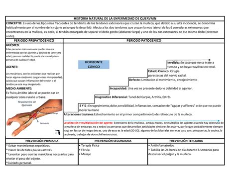 Historia Natural DE LA Enfermedad DE Quervain HU AGENTE Estado