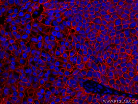 E Cadherin Antibody CL594 60335 Proteintech