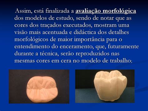 CURSO PRÓTESE DENTÁRIA ENCERAMENTO PROGRESSIVO I ppt carregar