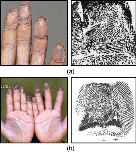 altered fingerprints detection and localization deepai