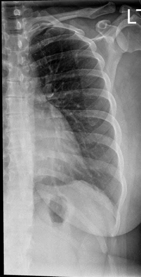 Image Radiopaedia Org
