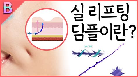실리프팅 딤플은 왜 생기는 걸까 리프팅시술 YouTube