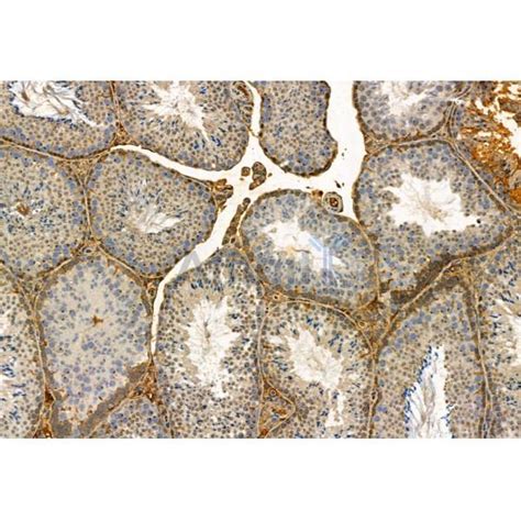 FAP1 Antibody Affinity Biosciences LTD 亲科生物官网