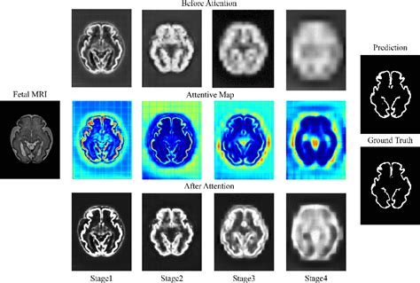frontiers fetal cortical plate segmentation using ful