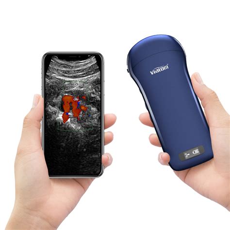 In Wireless Ultrasound Scanner Viatom