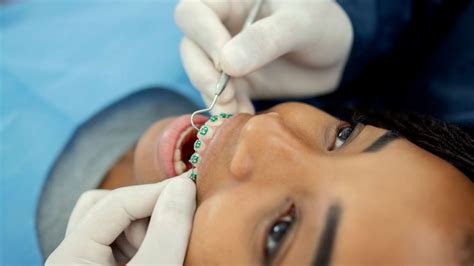 Saiba Como Usar Fio Dental Aparelho Corretamente Clinica OralDents