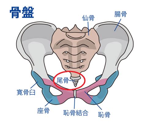 尾てい骨骨折の後遺症で示談するときに注意すべき5つのポイント