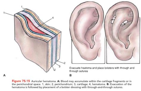Anatomy Of The Ear Flashcards Quizlet