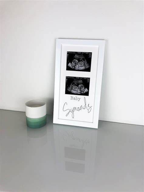 Personalised Ultrasound Baby Scan Print 2app Pregnancy Picture Photo