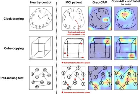 visual explanations provided by the multi input vgg16 model with download scientific diagram
