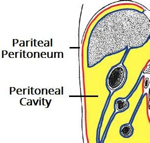 The Acute Abdomen Causes Management TeachMeSurgery