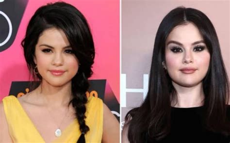 El antes y el después de Selena Gomez la belleza de la cantante ha