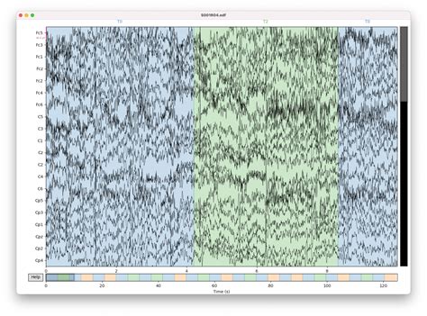 Clemens Brunner Visualizing EEG Data
