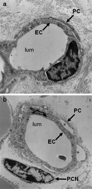 Electron Micrograph Of Endothelial Pericyte Associations A A