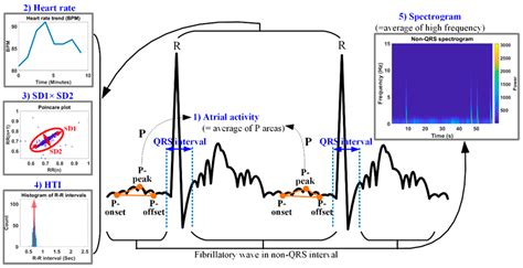 sensors free full text an adaptive median filter based on sampling rate for r peak detection