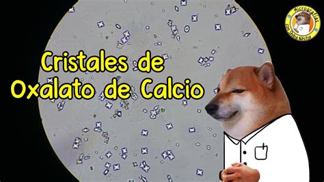 Explorando la belleza de la morfología de los cristales de oxalato de