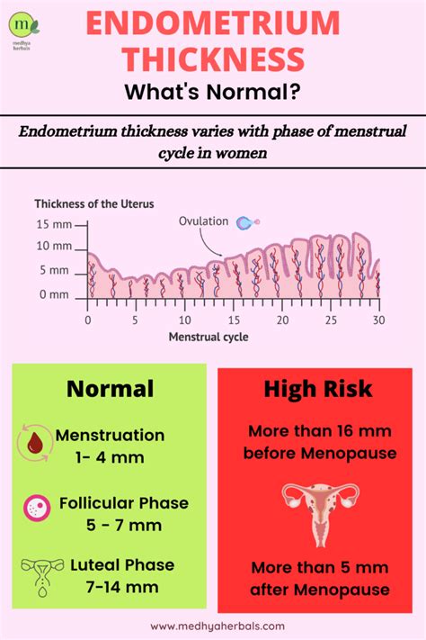 How To Reduce Endometrial Thickness Naturally